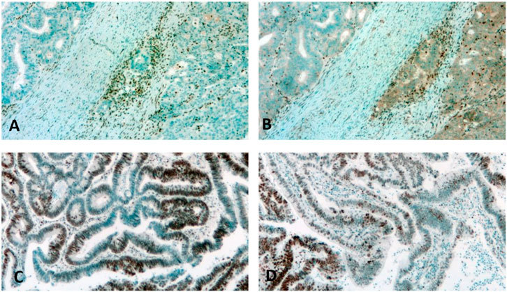 Pathology & Oncology Research | Microsatellite instability and mismatch ...