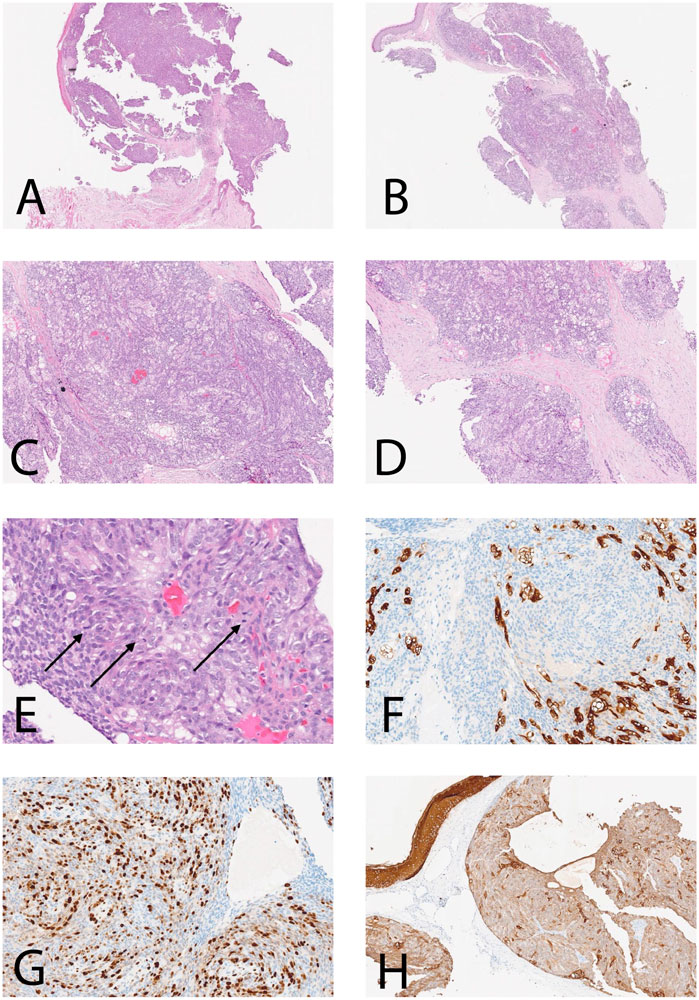 Pathology & Oncology Research | Case report: A rare case of oral ...