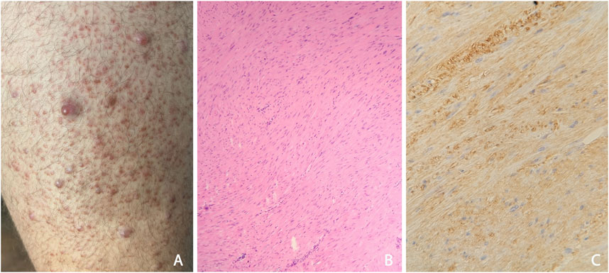 Pathology & Oncology Research | Timely recognition of a probably life ...